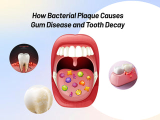 Dental Bacterial Plaque Causes Gum Disease - The Best Way to Prevent ...